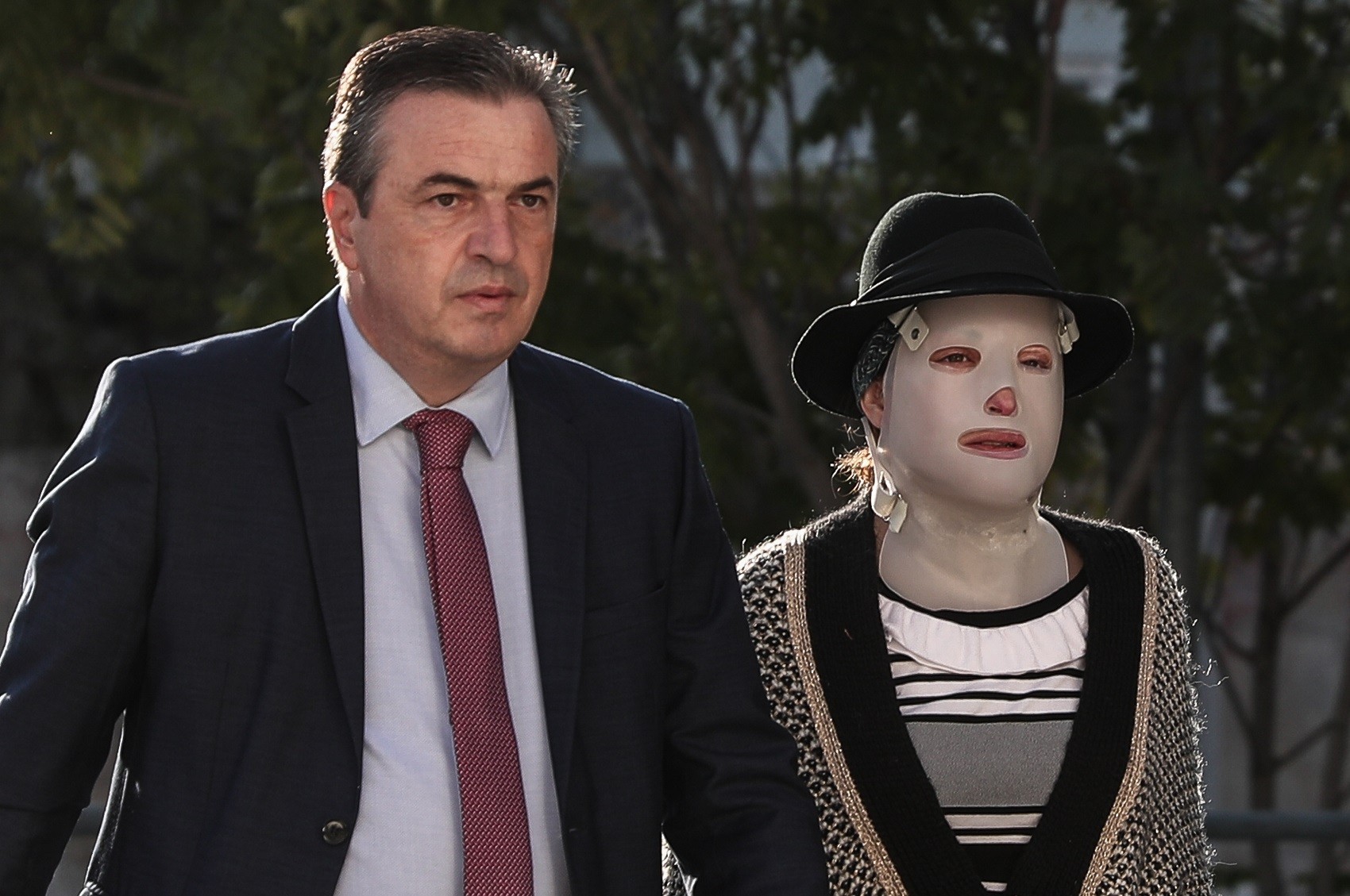 Επίθεση με βιτριόλι: Απούσα από τη δίκη η κατηγόρουμενη | topontiki.gr