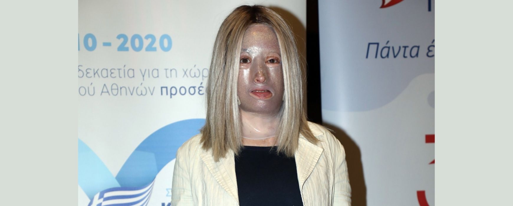 Ιωάννα Παλιοσπύρου: Ανέβασε στο Instagram την πρώτη φωτογραφία χωρίς ...