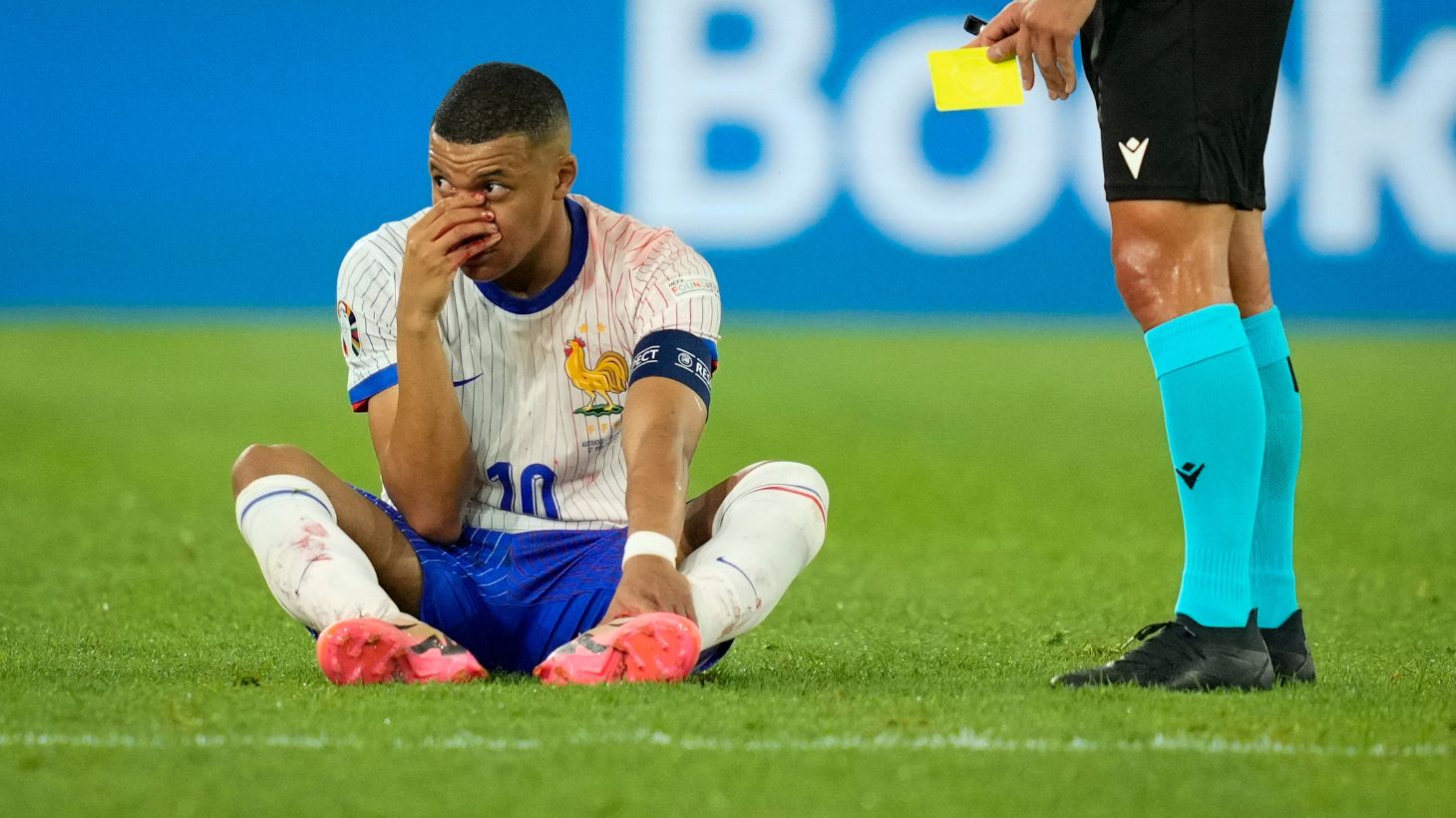 Euro 2024: Κάταγμα στη μύτη ο Μπαπέ – Συνεχίζει με προστατευτική μάσκα ...