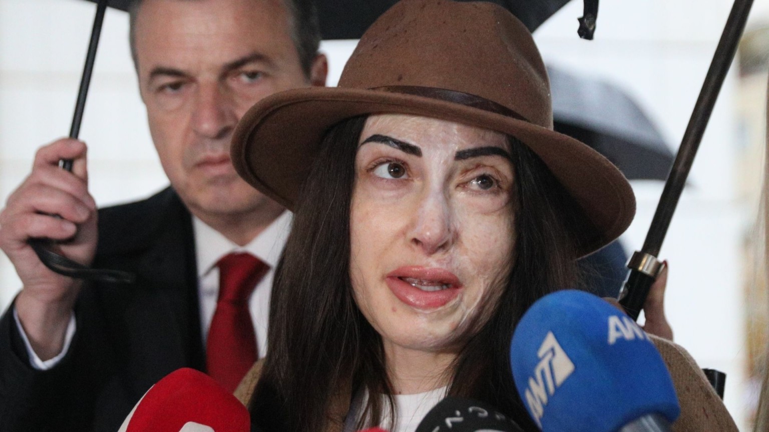 Επίθεση με βιτριόλι: Για τις 16 Ιανουαρίου διεκόπη η δίκη – «Θεωρώ πως ...