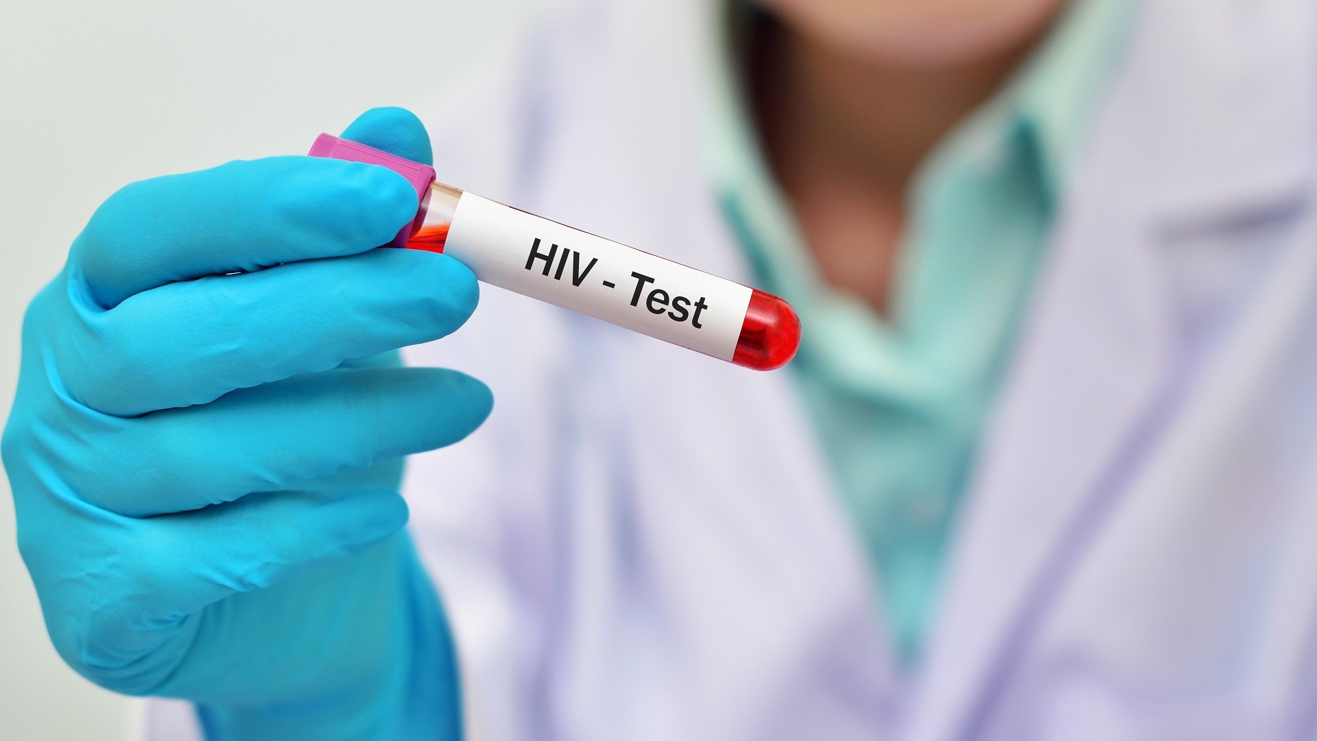 ECDC: «Επιδημία» HIV στην Ευρώπη – Οι μισοί φορείς διαγιγνώσκονται με ...